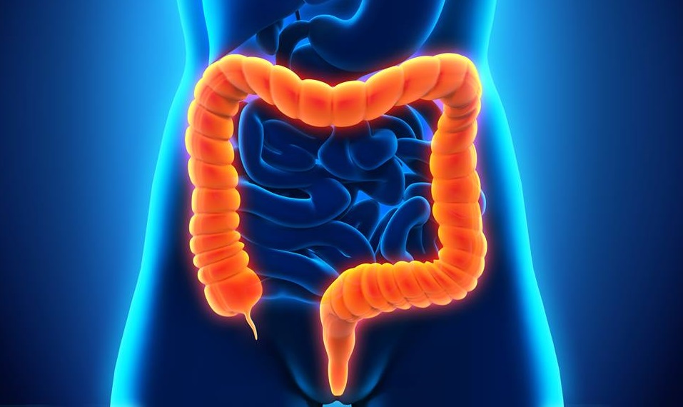 Diverticulite: sintomas e tratamentos - TV Gazeta - Você por perto ...